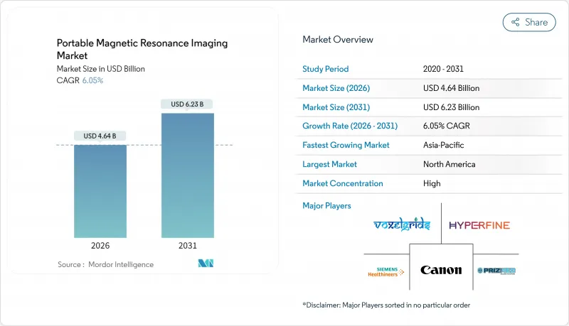 Portable Magnetic Resonance Imaging - Market Share Analysis, Industry ...